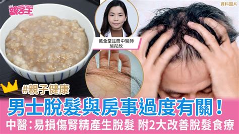中醫解構男士脫髮成因 原來因房事無節制致腎精不足！附兩大簡單食療