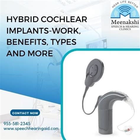 Hybrid Cochlear Implants Work Benefits Types And More Meenakshiclinic On Tumblr