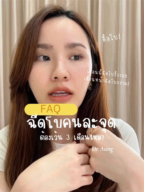 Botox ฉีดคนละจุดต้องเว้น 3 เดือนไหมคะ วิดีโอที่เผยแพร่โดย Thewika T