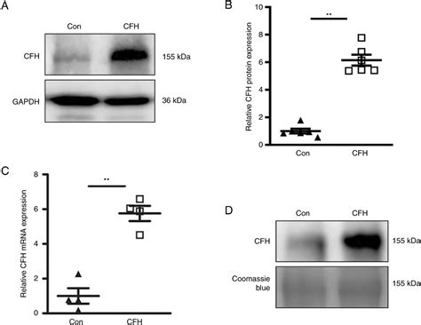 Figure 1 From Complement Factor H Inhibits Endothelial Cell Migration
