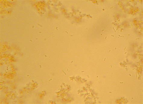 Bacteria In Yogurt Compound Microscope Yogurt Under The Microscope