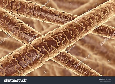 Microscope Slide Of Hair At Misty Orth Blog