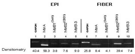 Spatial Analysis Of Indicated Msr Transcripts In Microdissected Human