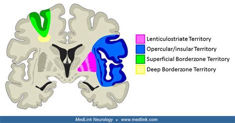 Stroke Syndromes And Anatomic Localization Medlink Neurology