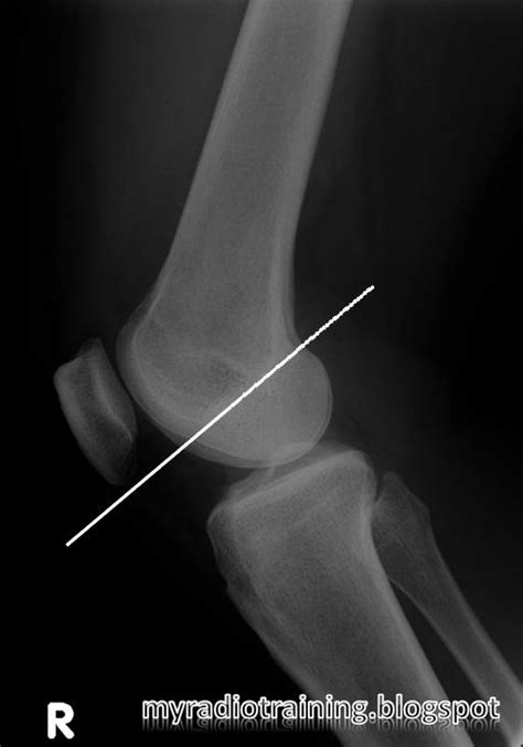 Radiology Info Hub Musculoskeletal