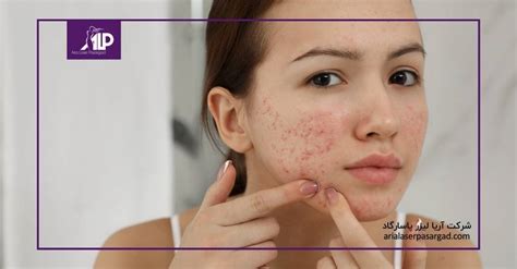 لکه‌های پوستی راهنمای کاربردی برای درمان و پیشگیری آریا لیزر پاسارگاد