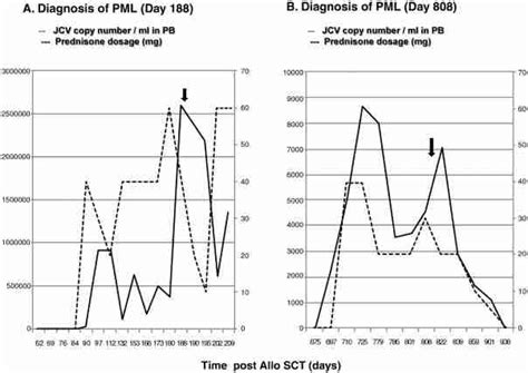 Jcv Load Dependent On Time From Transplant And Steroid Dose A