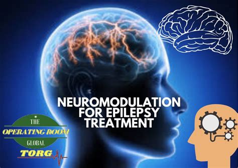 Neuromodulation For The Treatment Of Epilepsy The Operating Room