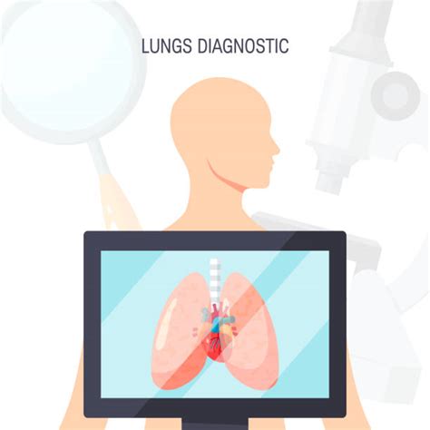 Tuberculosis Testing Illustrations Royalty Free Vector Graphics And Clip