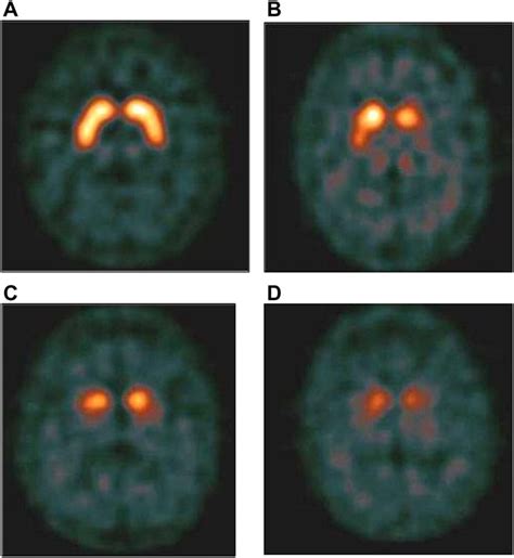 Datscan Studies Superhero Logos Art