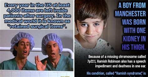 33 Medical Oddities That We Cant Believe Are Actually Real