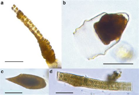 Heterotrophic Examples