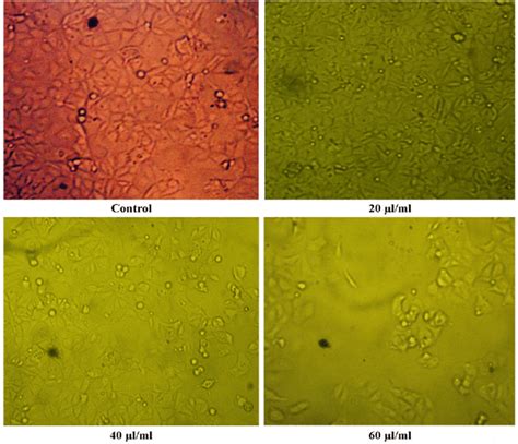 The Morphological Analysis Of The Morphology Of The Cancer Cell Using Download Scientific