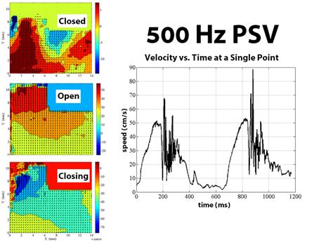 Particle Shadow Velocimetry Issi