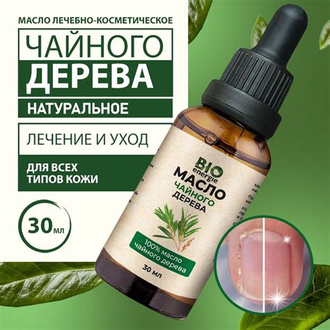 Масло чайного дерева для ногтей / 30 мл / BIOENERGIE купить на OZON по ...