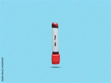 Test Tube With Blood Sample For HDL High Density Lipoprotein Test Lipid Profile Good
