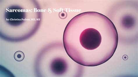 Soft Tissue And Bone Sarcomas By Christina Padron On Prezi