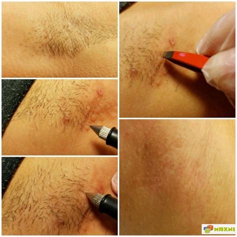 Интимная стрижка в зоне глубокого бикини 89 фото