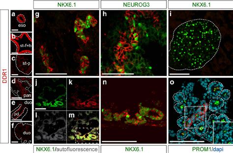 Ddr1 Marks Pancreatic Progenitors In Mouse And Human Ddr1 Red Is Download Scientific