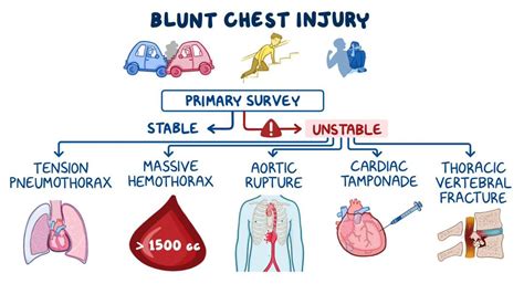 Approach To Blunt Chest Injury Clinical Sciences Osmosis Video Library