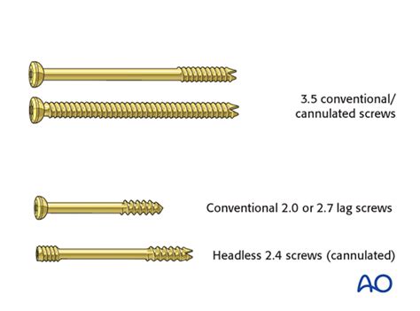 Orif Lag Screw Fixation For Glenoid Fossa Partial Articular