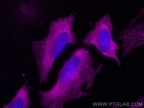 Septin 9 Antibody Cl647 10769 Proteintech