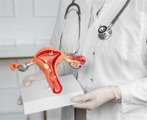 Bagi Perempuan Penyebab Kanker Serviks Dan Mencegahnya Egindo