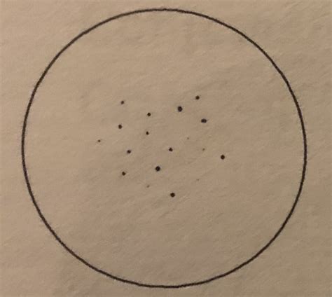 Corneal Staining Patterns Flashcards Quizlet