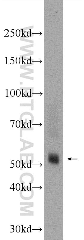 Tmprss5 Antibody 24616 1 Ap Proteintech