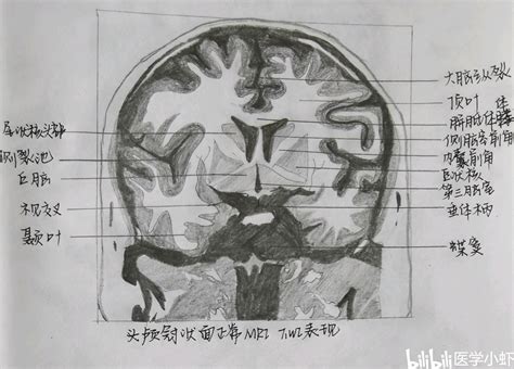 脑冠状面冠状面矢状面 伤感说说吧