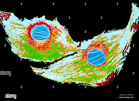 Fibroblast Cells Coloured Transmission Electron Micrograph Tem Of A Section Through Mammalian