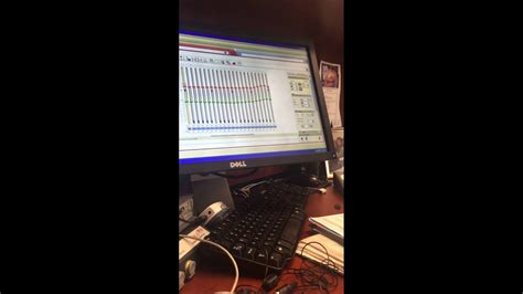 Cochlear Implant Mapping Part Youtube