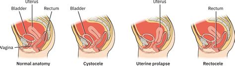 6 3 Structural Disorders Medicine Libretexts