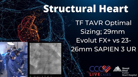 Tf Tavr Optimal Sizing 29mm Evolut Fx Vs 23 26mm Sapien 3 Ur Youtube