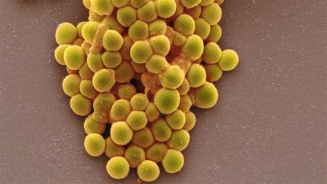 Streptococcus Thermophilus Bacteria Coloured Scanning Electron Micrograph Sem Stock Video