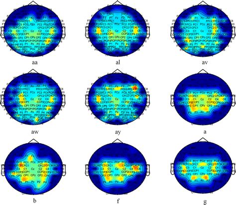 Brain Topographic Map Of The Distribution Of Selected Channels On