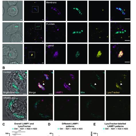 Dram1 Colocalises With Acidified Mycobacteria Containing Vesicles A