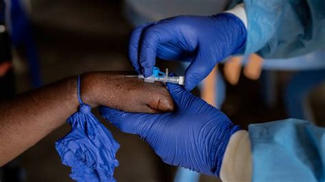 Mpox Diagnosis Who Approves First Testing Kit Here Are Details