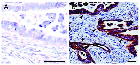 Immunohistochemical Analysis Of Src Expression A Negative Staining