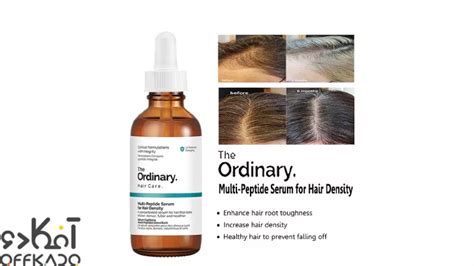 خرید سرم ضد ریزش موی مولتی پپتید اوردینری با تخفیف