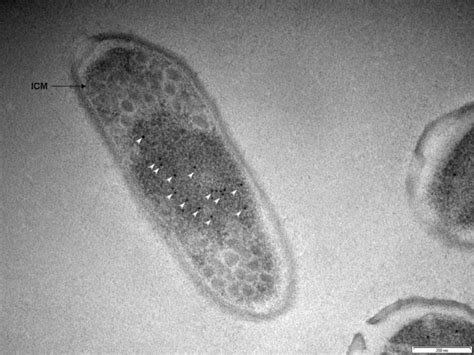 Verrucomicrobia Alchetron The Free Social Encyclopedia