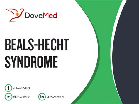 Beals Hecht Syndrome Dovemed