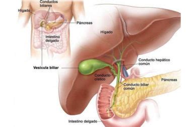 Litiasis biliar Qué es Síntomas causas y tratamiento