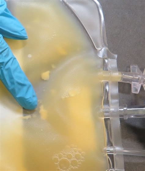 Platelets Particulate Matter Professional Education