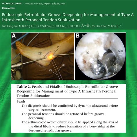Arthroscopy Journals On Linkedin 🦶peroneal Tendon Subluxation Learn A