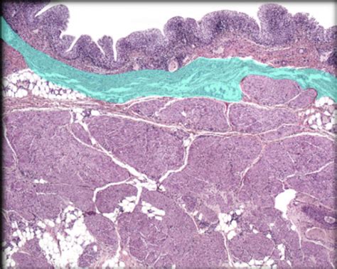 Urinary System Histology Flashcards Quizlet