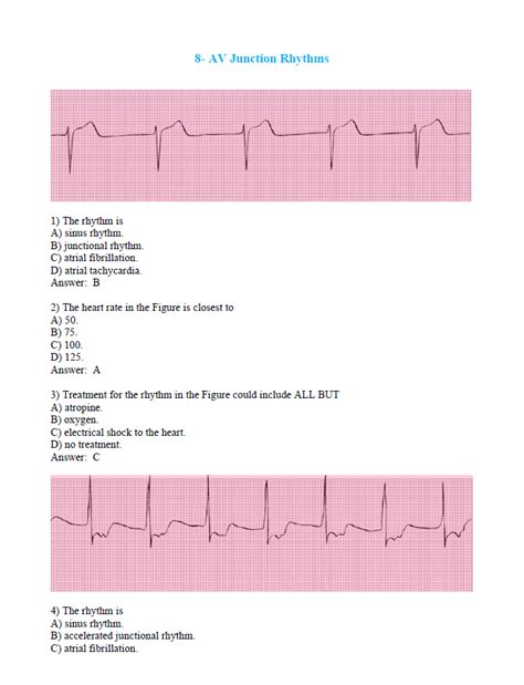 Av Junction Rhythms Ekg Interpretation And Exam Questions Schootex