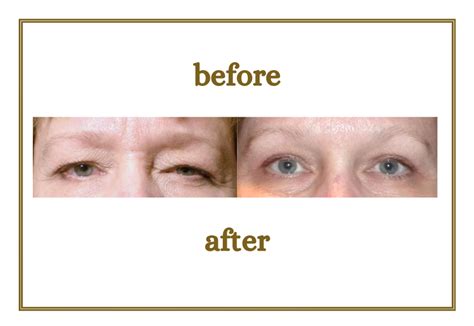 Meet Dr Lee A Renowned Oculo Facial Plastic Surgeon Known For His