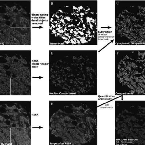 A Schema Of Construction Of A Tissue Microarray Cores From Hundreds Of