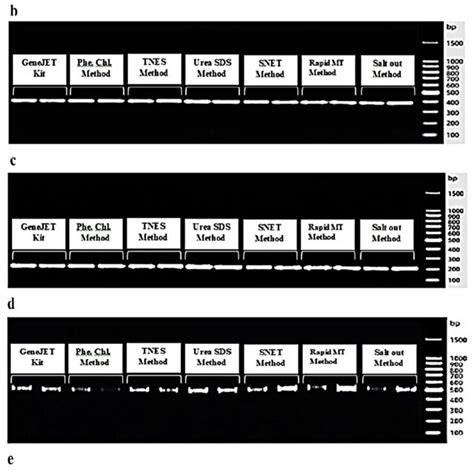 Pcr Amplification Comparison Between Seven Different Dna Isolation